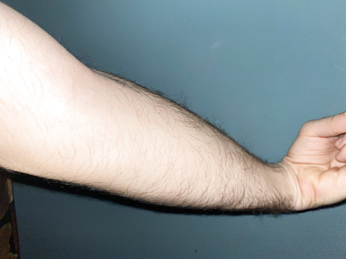 My Forearm Image 2355363 Thisvid Tube