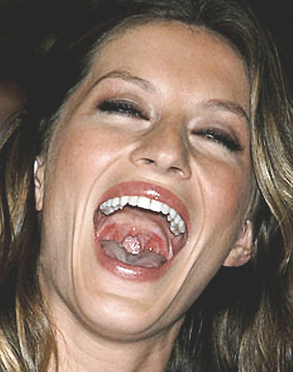 Tonsils Throat Uvula Image 2448273 Thisvid Tube