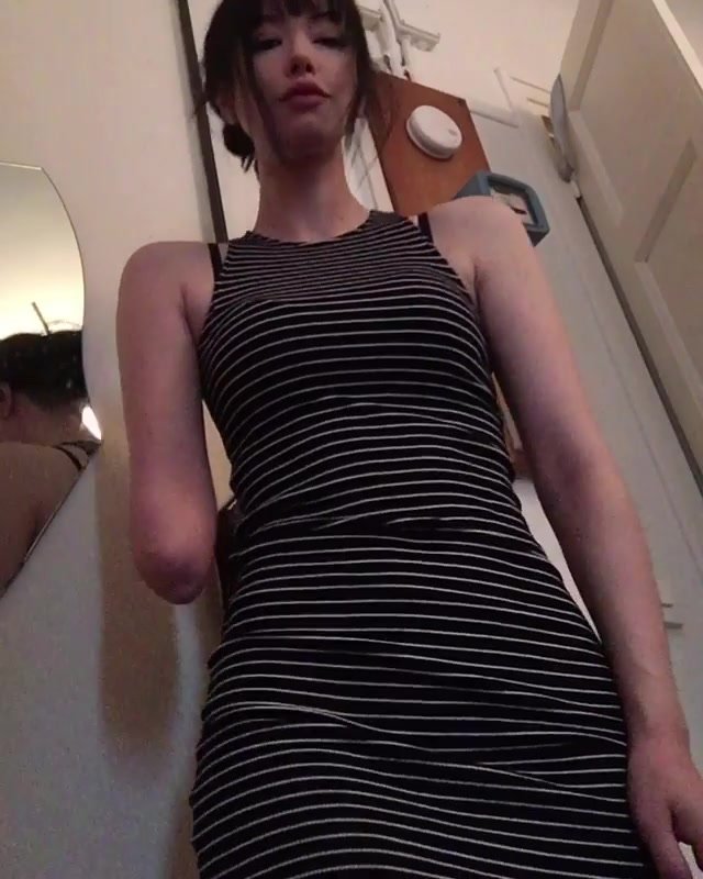 Sbe Amputee Video 4