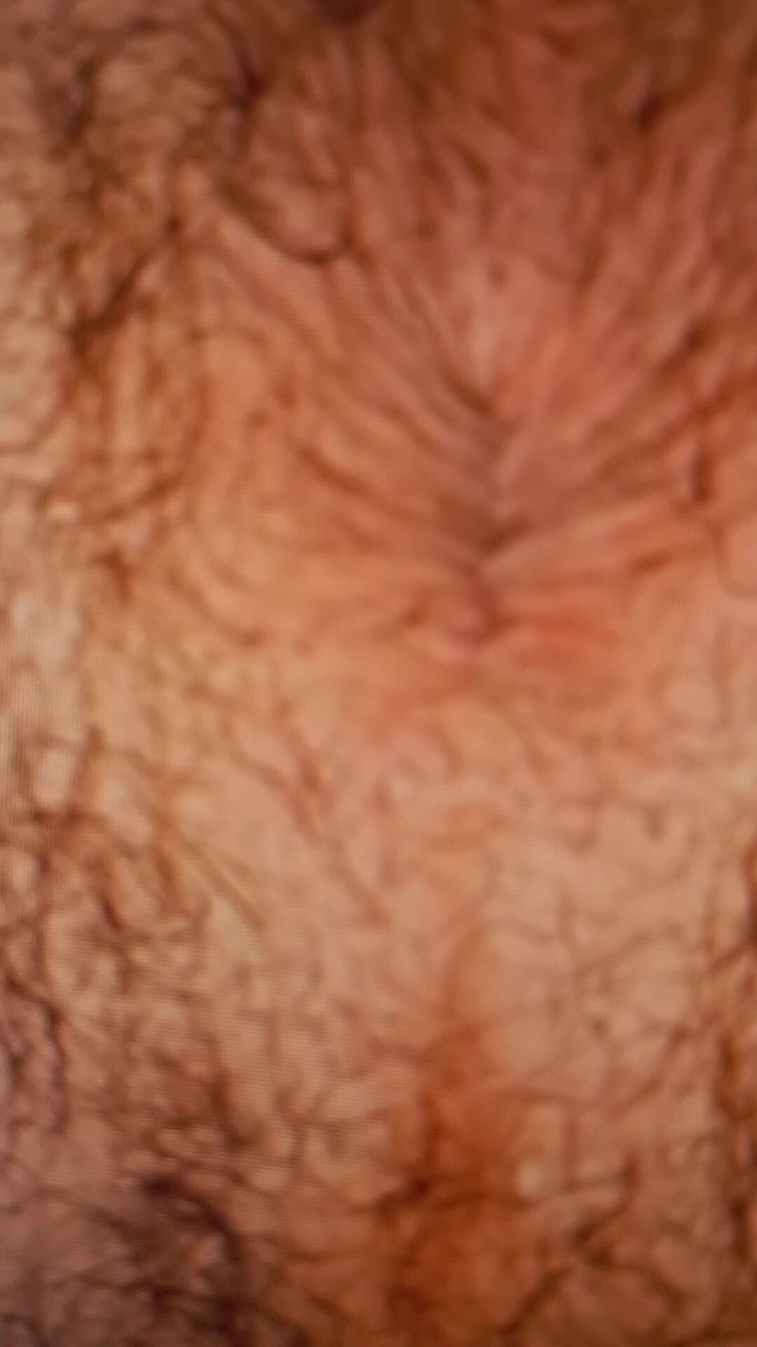 Hairy Hole Winking