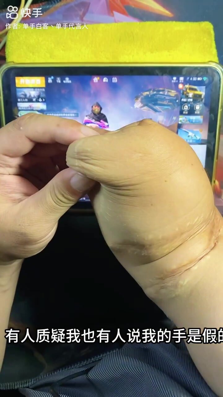 Sbe Amputee 2 日本語で