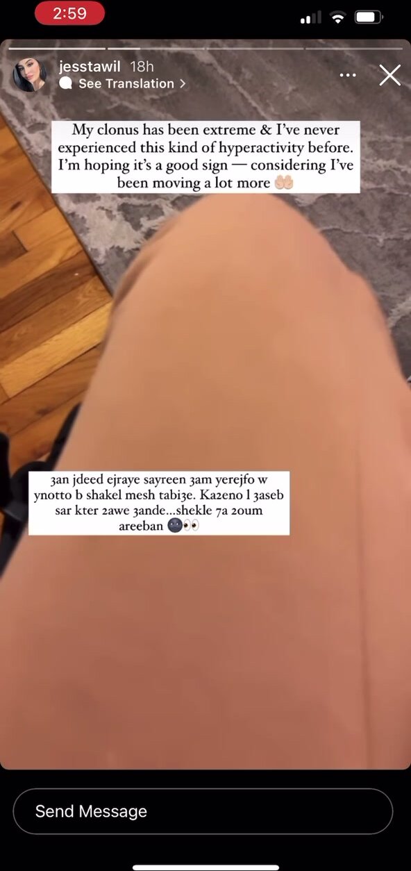 Leg Spasms