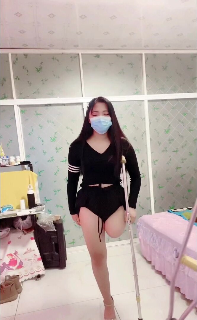 Amputee Chinese Showing Stump