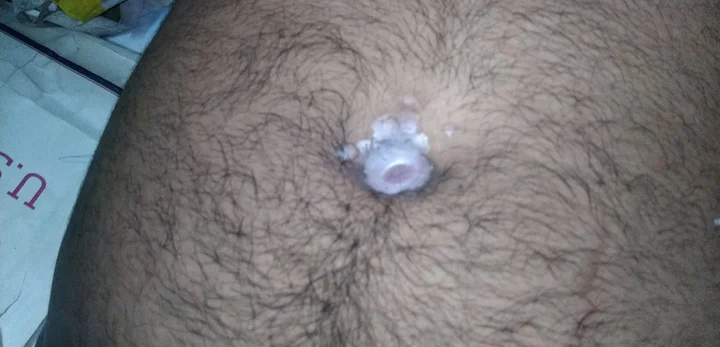 Hot Candle Wax In My Navel