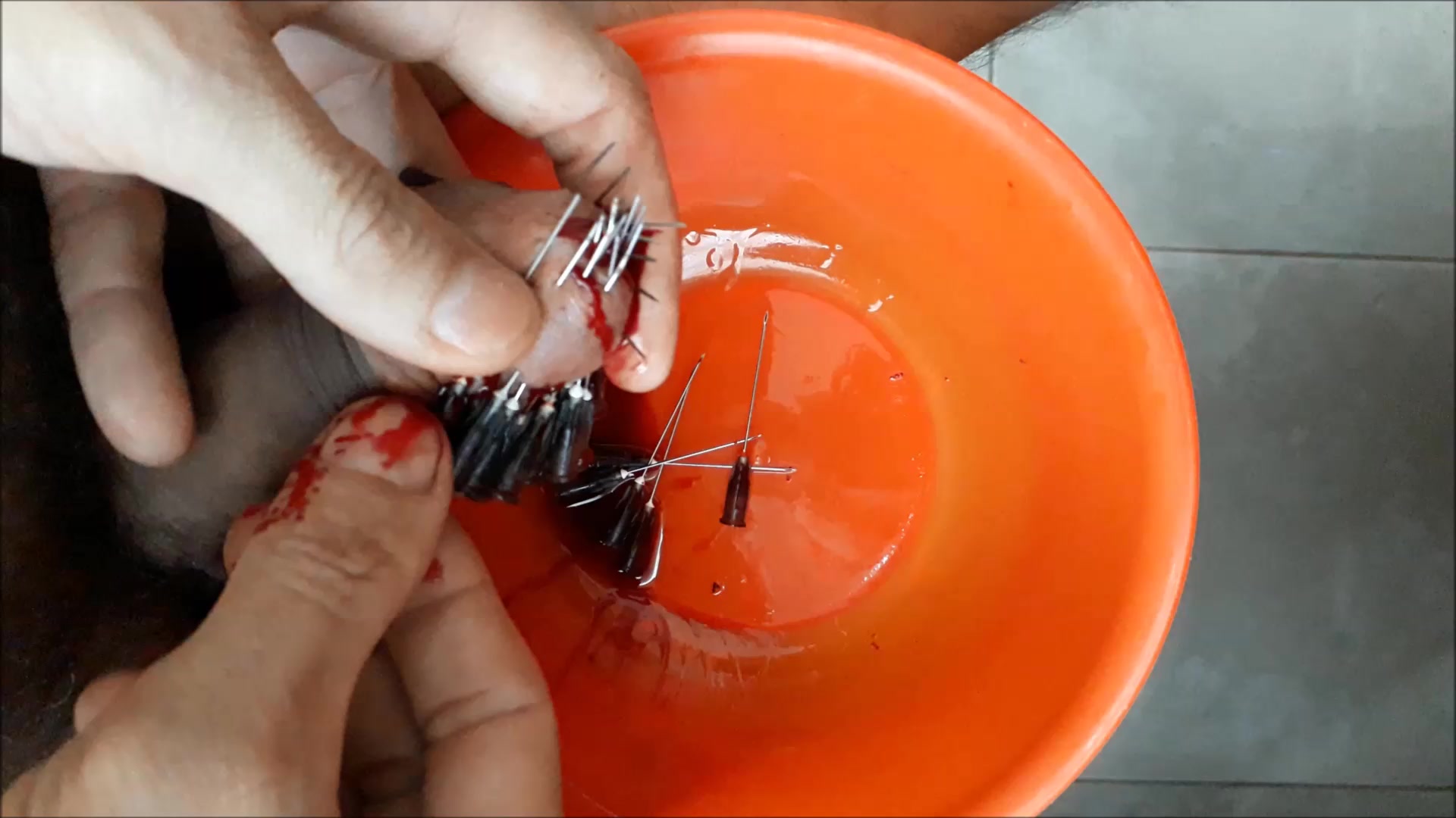 Removing The Needles From The Back Of My Cockhead