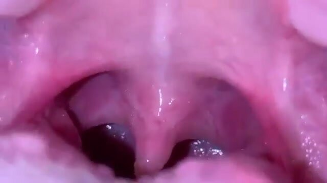 French Uvula