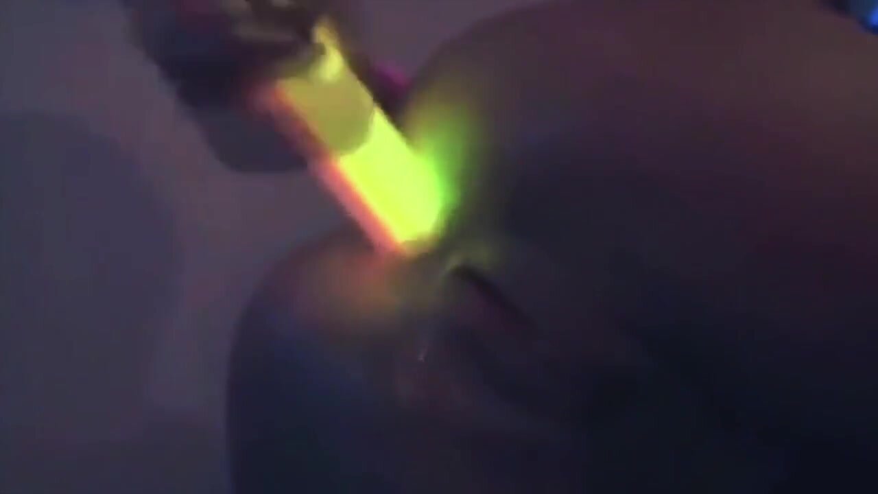 Best Anal