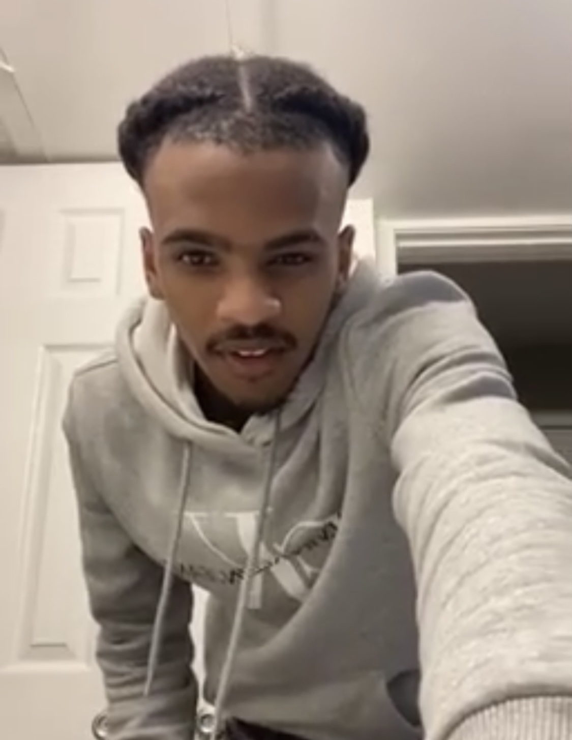 19 Year Old Shows Phimotic Bbc