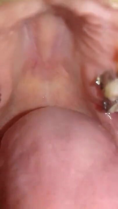 Bbw Inside Mouth