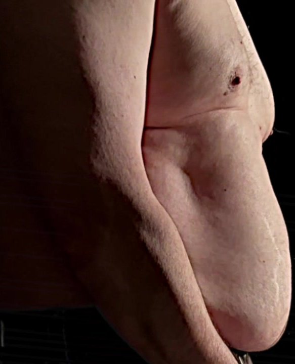 Hear Inside The Gut Being Digested