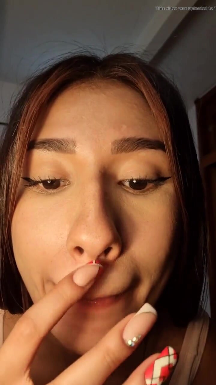 Extremely Long Uvula