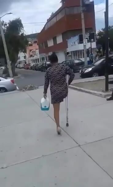 Amputee Sak Walking Whit One Crutch