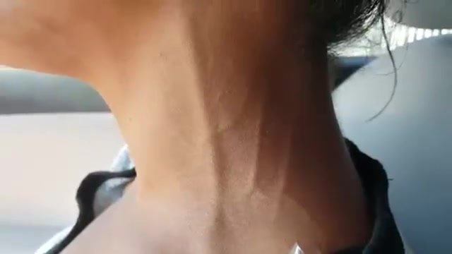 Neck Veins Video 11