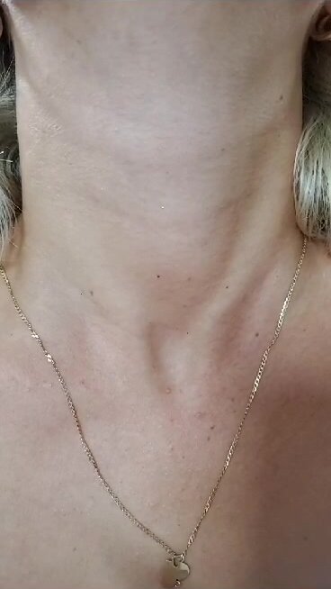 Hailwodanexample 2 Britany Visible Neck Pulse Improved