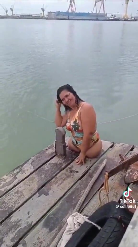 Dak Amputee Video 33