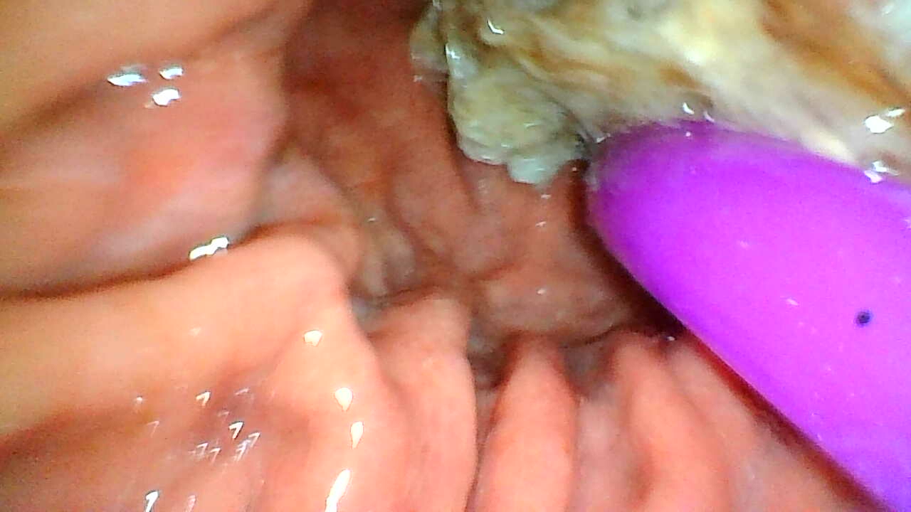 Stomach Trash Can