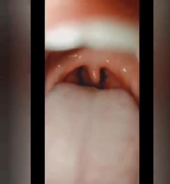 Instagram Girl Open Mouth Close Up 2