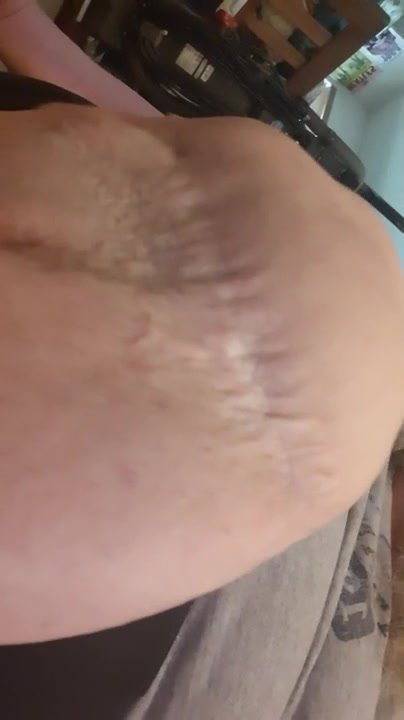 Bbw Stump Big